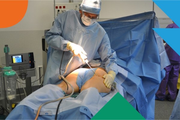 Liposuction Advertising Tips | Adbetter