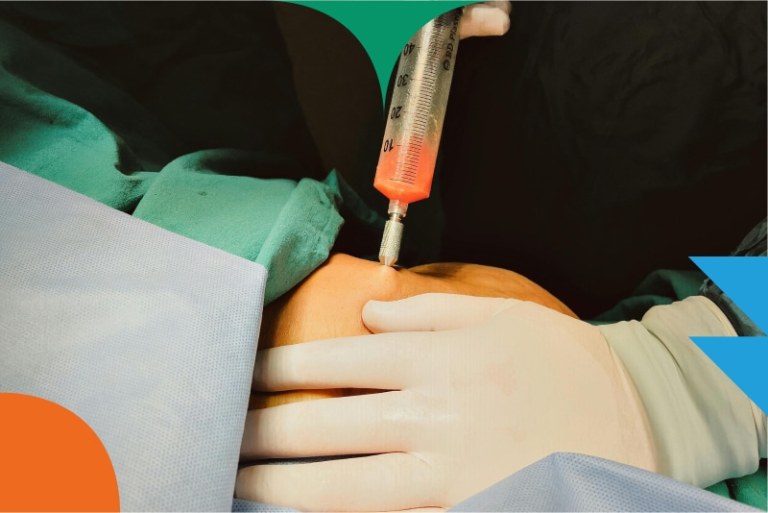 Liposuction Advertising Tips | Adbetter